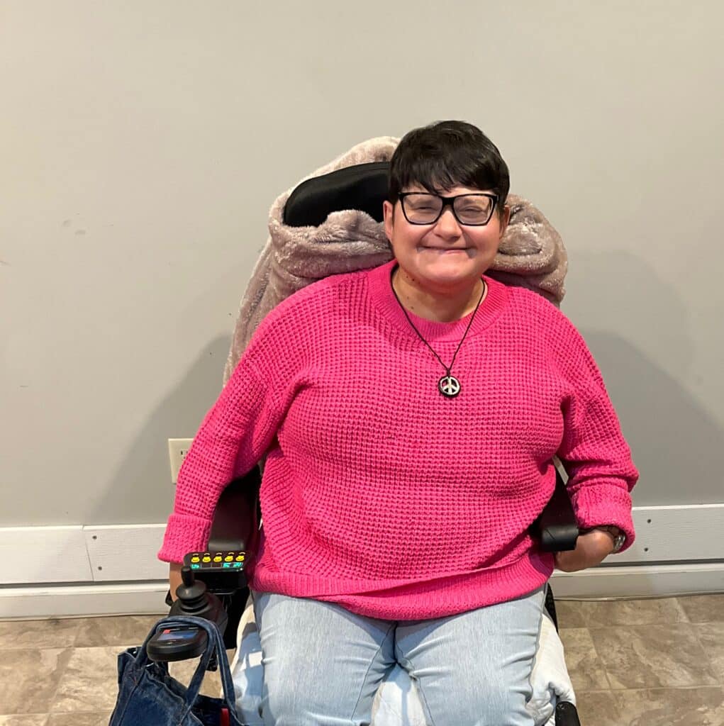 What’s up With the Scars on Jesus’ Resurrected Body? » Christian ...